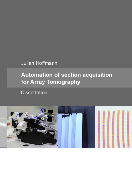 Automation of section acquisition for Array Tomography
